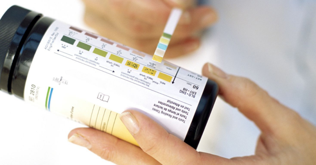 Ketose Teststreifen: Vergleich, Anleitung + Tipps um Ketone zu messen ...